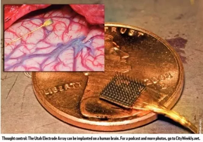 Brain Chip May Help the Blind See | News | Salt Lake City | Salt Lake ...